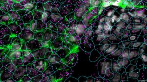 Spatial Biology Market Trends: Revenue, Price, Sales Analysis Report ...